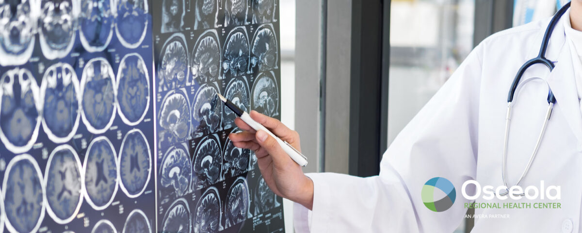 Stroke is one of the leading causes of death in the U.S. | Osceola ...